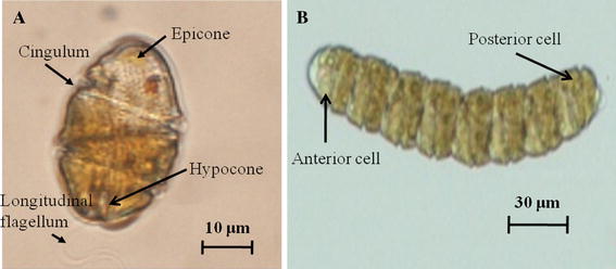 Determination of the swimming trajectory and speed of chain-forming ...