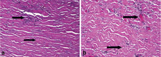 DermACELL: a novel and biocompatible acellular dermal matrix in tissue ...