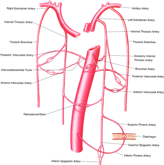 Aggressive Coiling of Aortopulmonary Collaterals in Single-Ventricle ...