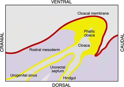 Congenital anomalies of the male urethra | SpringerLink