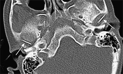 Use and accuracy of US guidance for image-guided injections of the ...