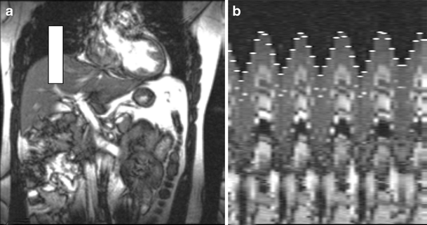 Magnetic resonance imaging in children: common problems and possible ...