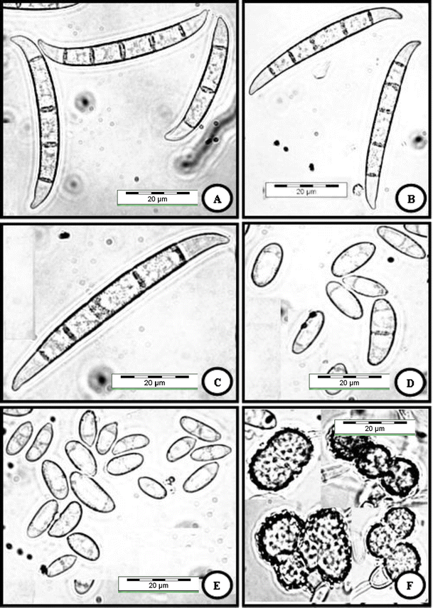 Morphological and Phylogenetic Analysis of Fusarium solani Species ...