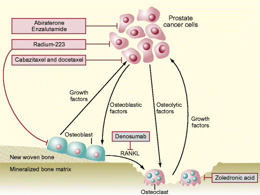 Practical recommendations for radium-223 treatment of metastatic ...