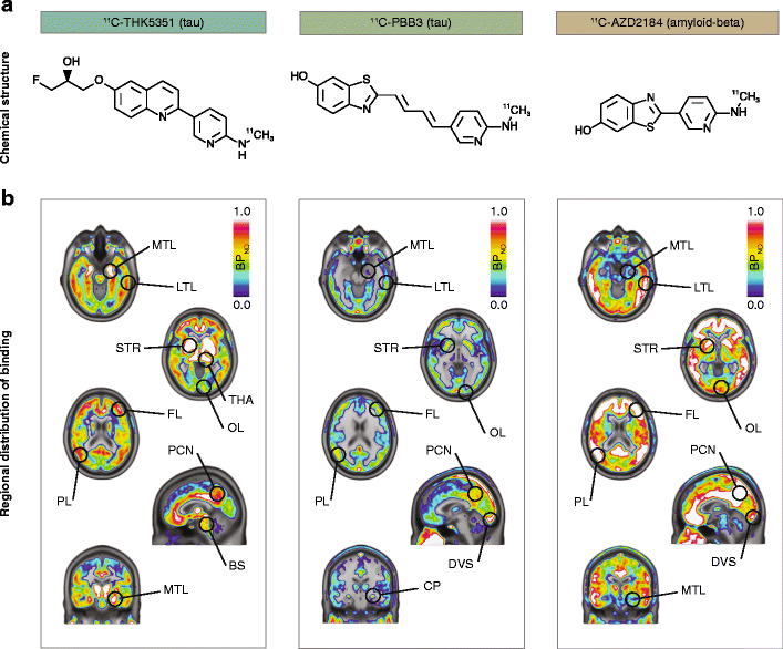 Dual tracer tau PET imaging reveals different molecular targets for 11C-THK5351 and 11C-PBB3 in ...