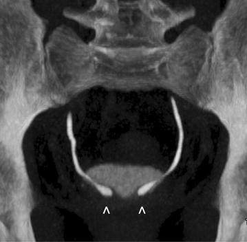 The cobra head sign | SpringerLink