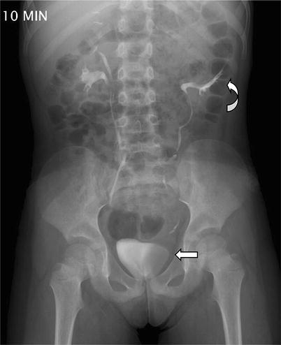 The drooping lily sign | SpringerLink