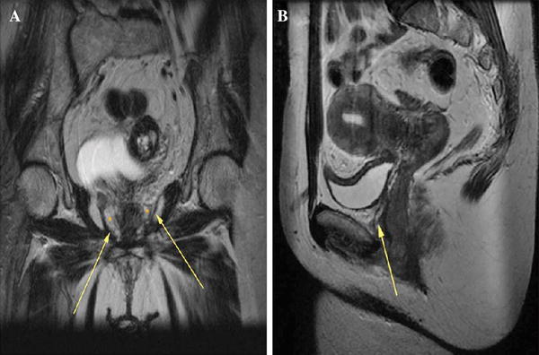 Cross-sectional imaging following surgical interventions for stress ...