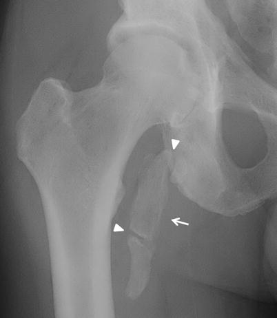 The “pelvic digit” | SpringerLink
