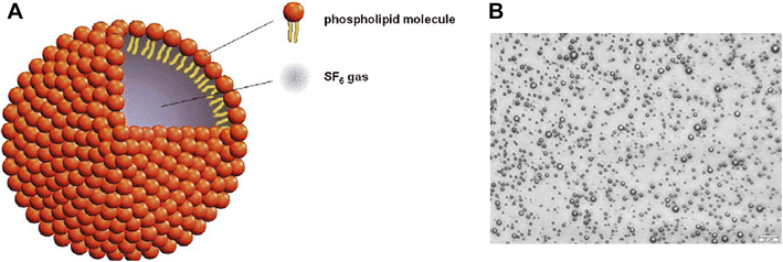 Imaging with ultrasound contrast agents: current status and future ...