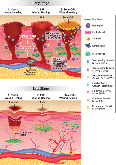 Early Intervention with Highly Condensed Adipose-Derived Stem Cells for ...