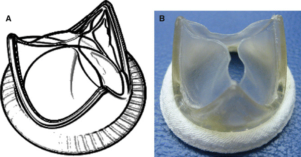 Tissue-Engineered Heart Valve: Future of Cardiac Surgery | SpringerLink