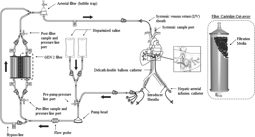 Evaluation of Delcath Systems’ Generation 2 (GEN 2) Melphalan Hemofiltration System in a Porcine ...