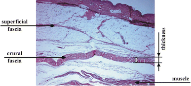 Mechanics of crural fascia: from anatomy to constitutive modelling ...