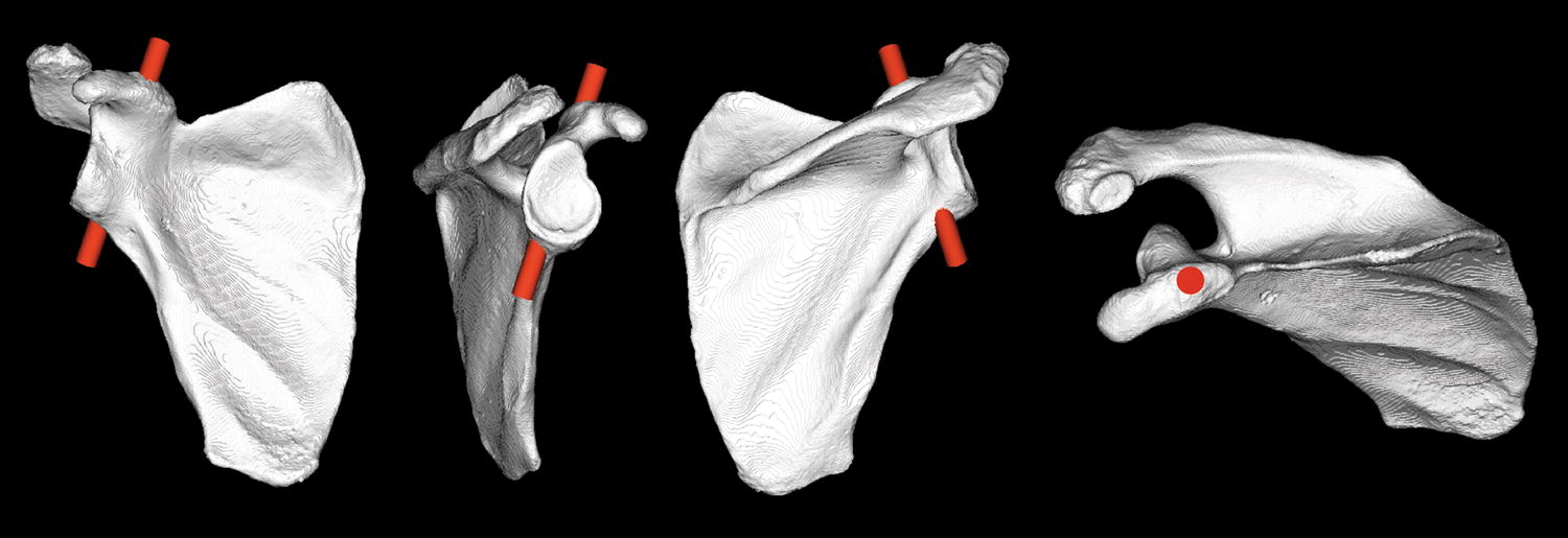 The “coracoid tunnel view”: a simulation study for finding the optimal ...