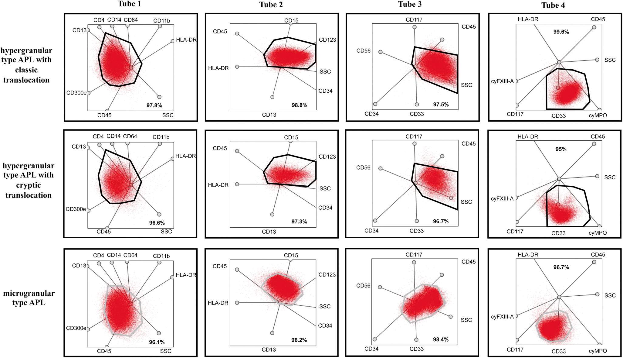 A novel flow cytometric method for enhancing acute promyelocytic ...