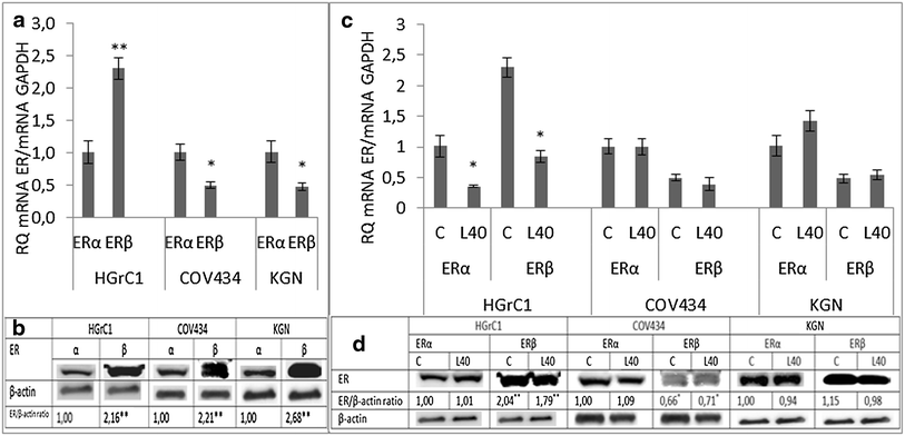 Superactive human leptin antagonist (SHLA), triple Lan1 and quadruple ...
