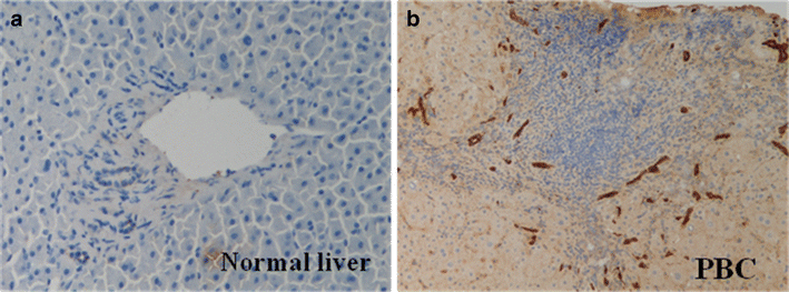 Liver architecture, cell function, and disease | SpringerLink