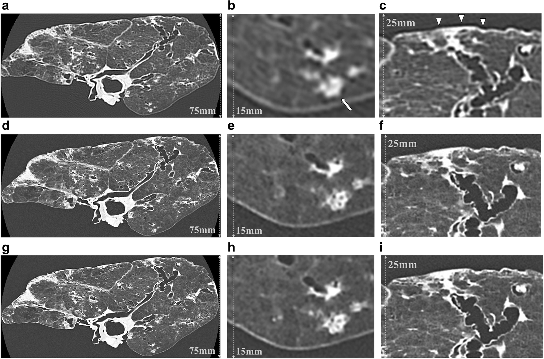 Subjective and objective comparisons of image quality between ultra ...
