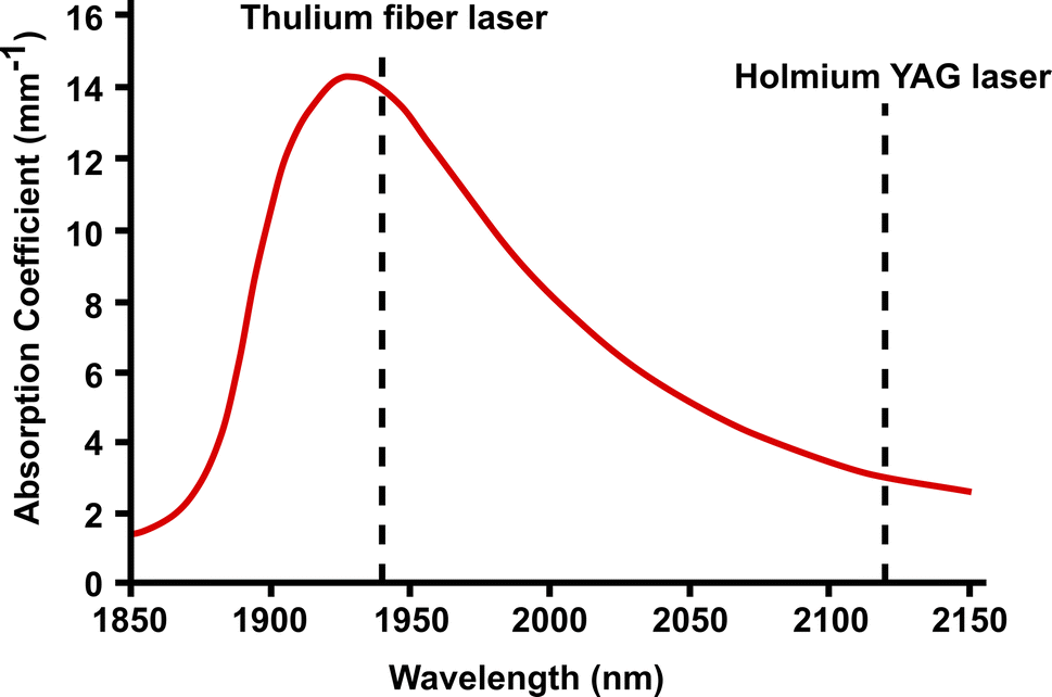 Thulium fiber laser: the new player for kidney stone treatment? A ...