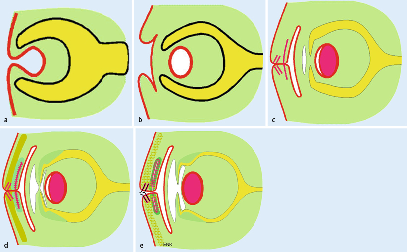 Meibom-Drüsen | SpringerLink