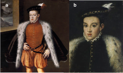 Brief account on the head injury of a noble youngster in the sixteenth ...