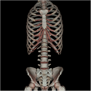 Lumbar ribs: a comprehensive review | SpringerLink