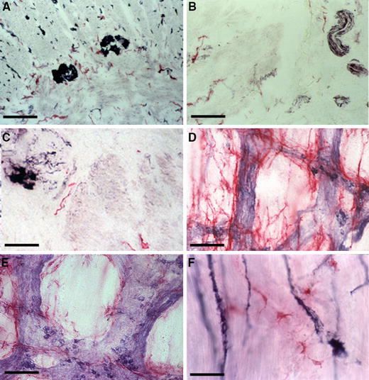 Interstitial cells of Cajal in the normal gut and in intestinal ...