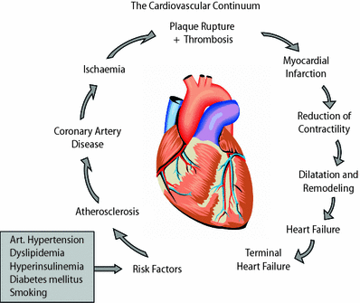 RAS blockade with ARB and ACE inhibitors: current perspective on ...