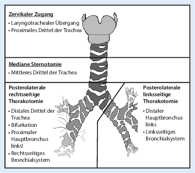 Strategien beim Thoraxtrauma | SpringerLink