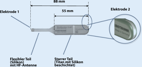 Implantierbarer Loop-Rekorder BioMonitor 2 (Fa. Biotronik) | SpringerLink