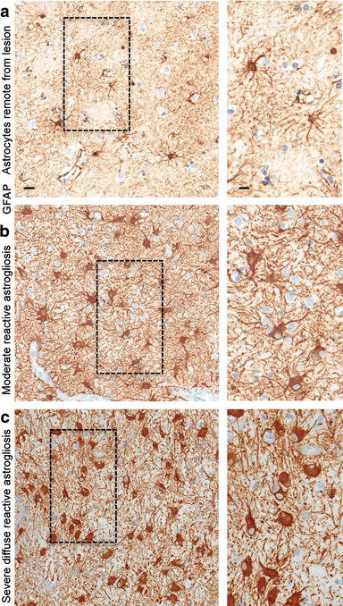 Astrocytes: biology and pathology | SpringerLink
