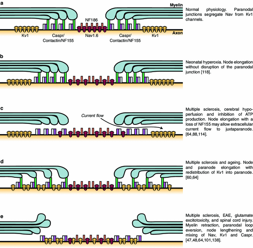 The node of Ranvier in CNS pathology | SpringerLink