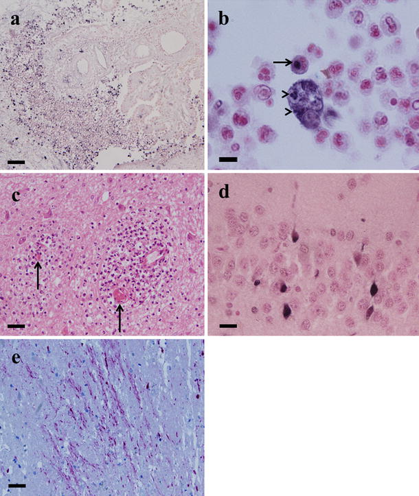 Host–pathogen interactions in bacterial meningitis | SpringerLink