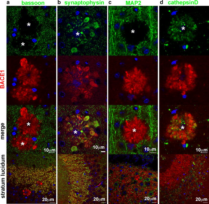 Presynaptic dystrophic neurites surrounding amyloid plaques are sites ...