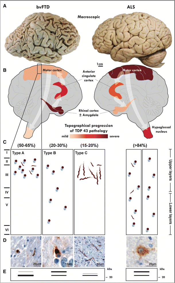 ALS/FTLD: experimental models and reality | SpringerLink