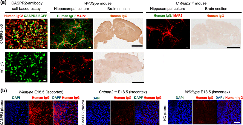 Persistent microglial activation and synaptic loss with behavioral ...