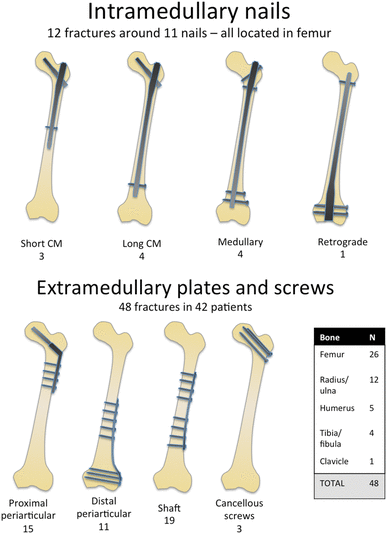 Non-prosthetic peri-implant fractures: classification, management and ...