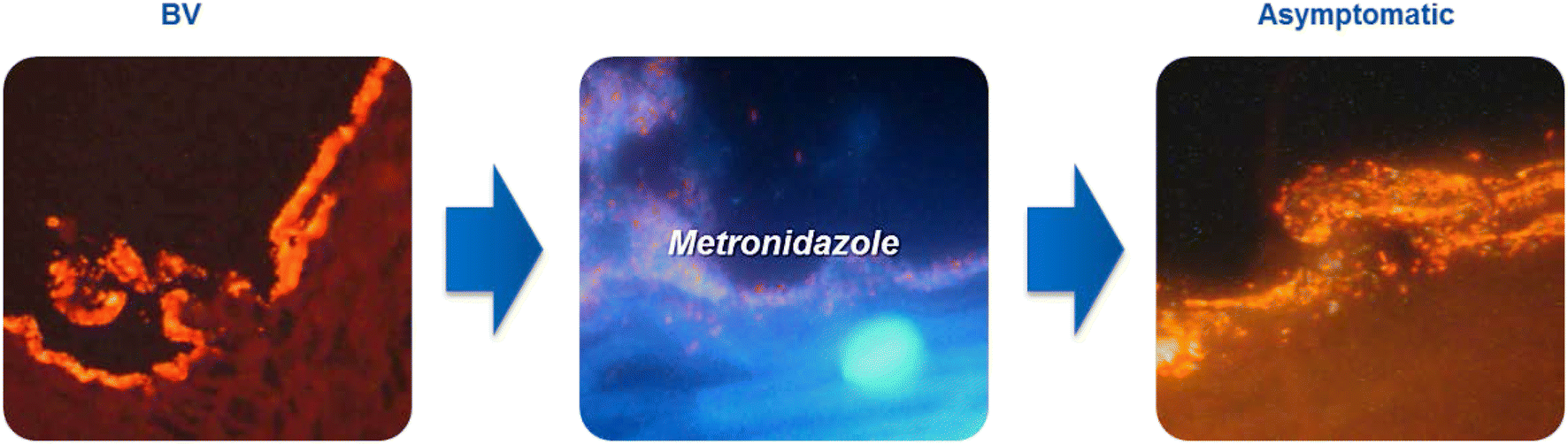 An update on the role of Atopobium vaginae in bacterial vaginosis: what ...