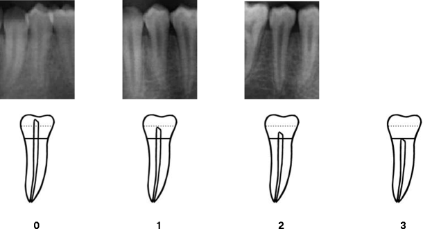 Radiographic evaluation of Gustafson’s criteria for the purpose of ...