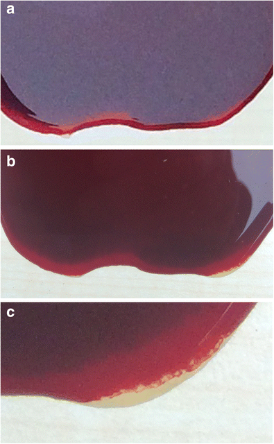 The ring phenomenon of diluted blood droplets | SpringerLink