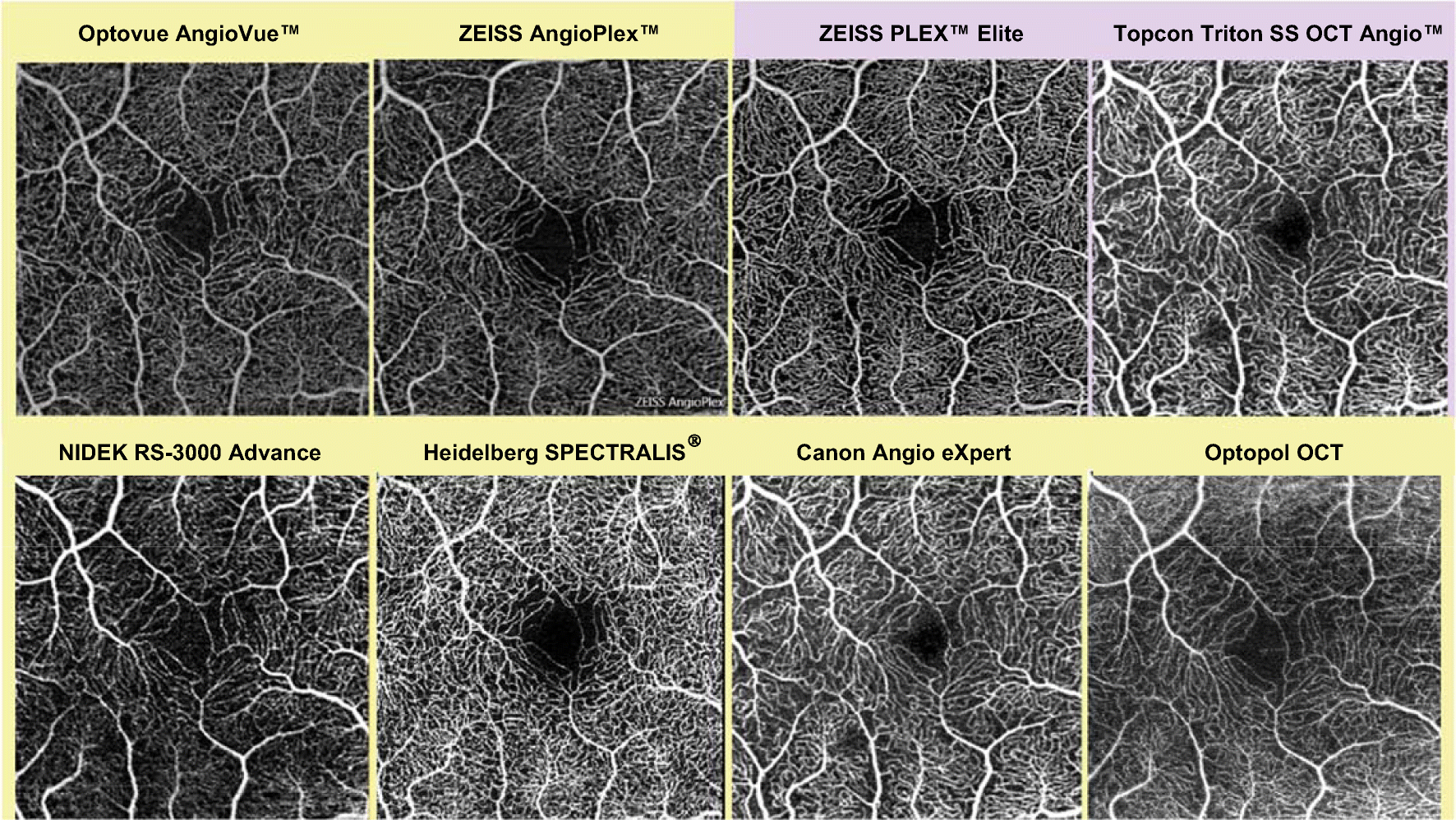 The role of OCT-A in retinal disease management | SpringerLink
