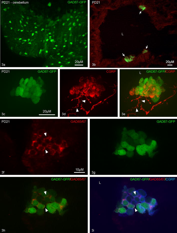 GABAergic signaling in the pulmonary neuroepithelial body ...