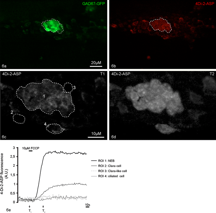 GABAergic signaling in the pulmonary neuroepithelial body ...