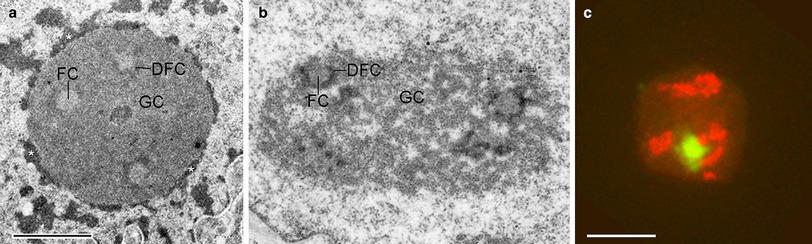 Nucleolus and chromatin | SpringerLink
