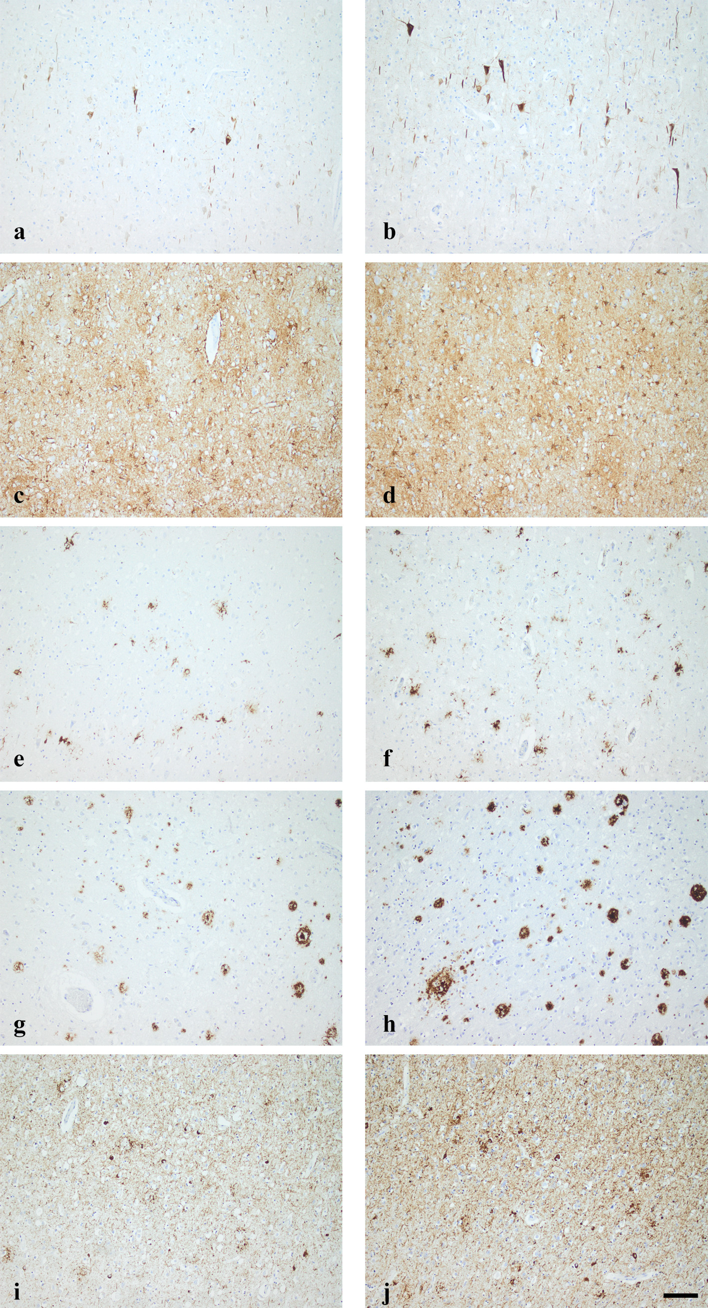 Characteristics of the tissue section that influence the staining ...