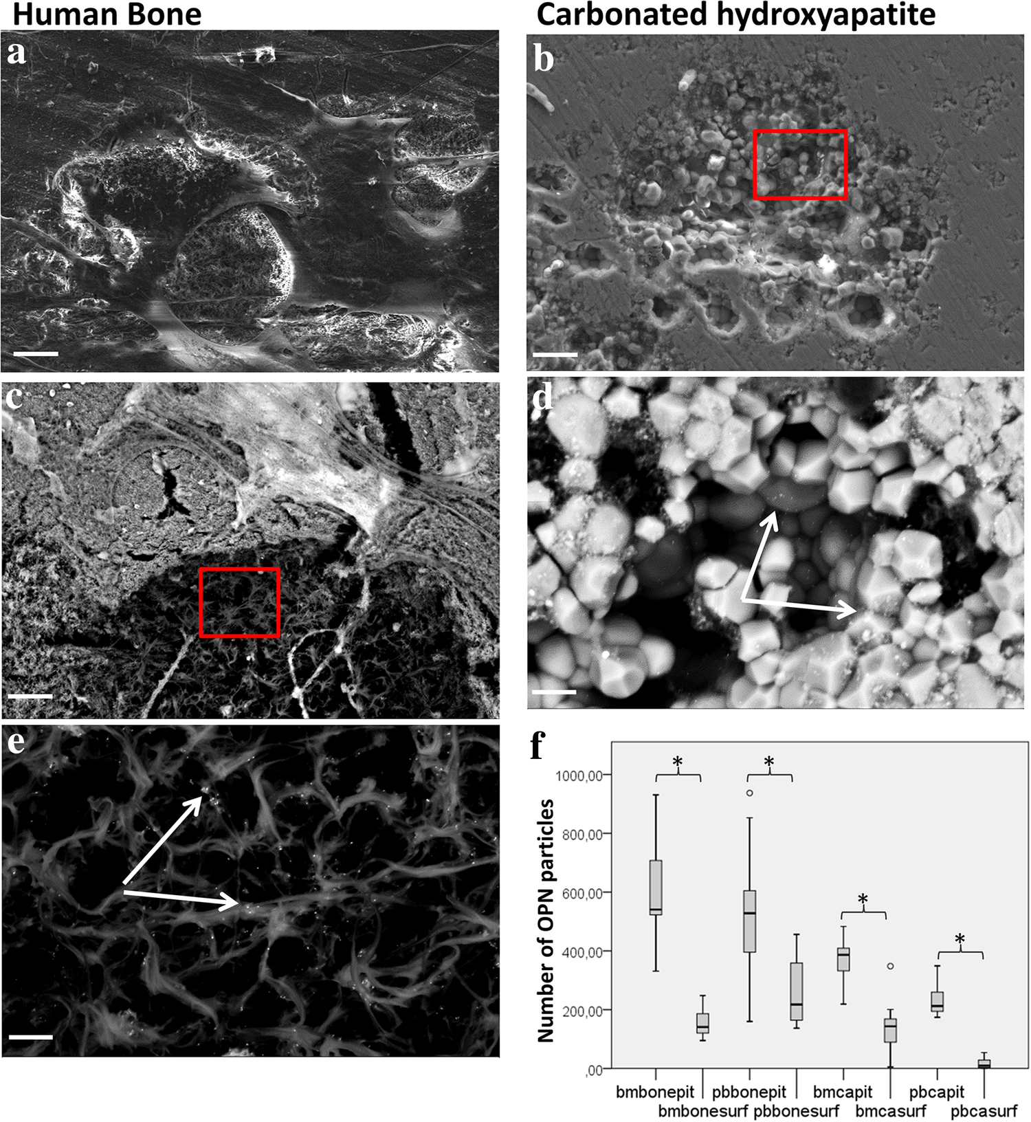 Osteoclasts secrete osteopontin into resorption lacunae during bone ...