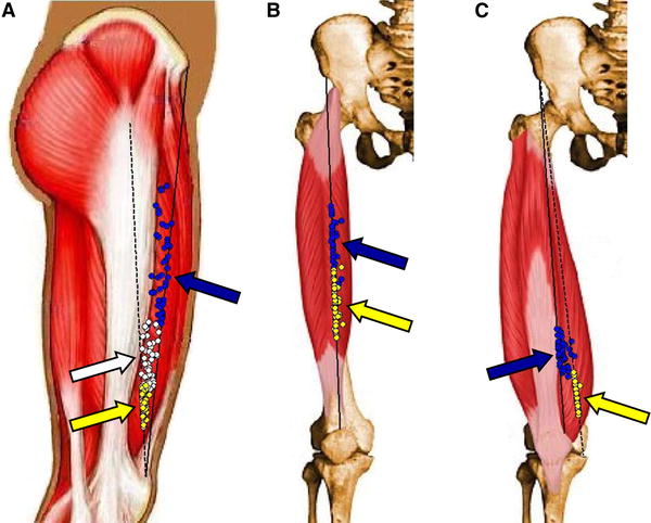 Atlas of the muscle motor points for the lower limb: implications for ...