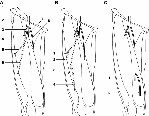 Atlas of the muscle motor points for the lower limb: implications for ...