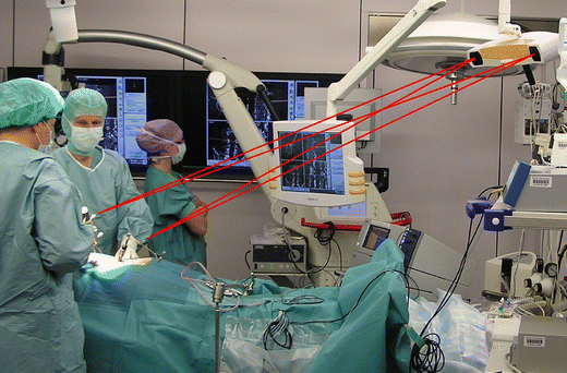 Navigation in surgery | SpringerLink
